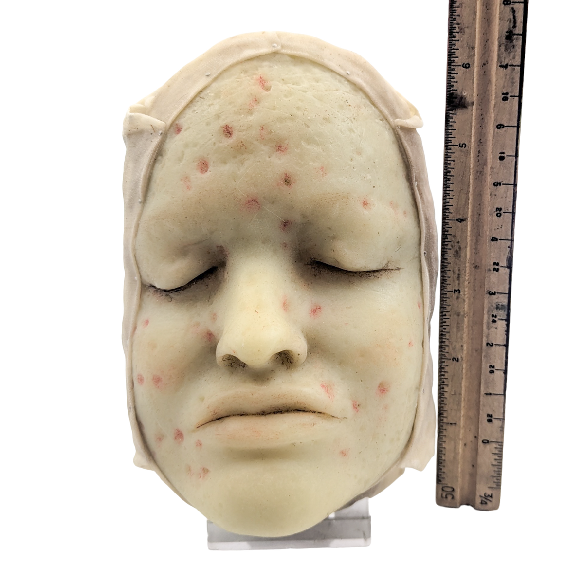 Antique Moulage Wax Pathology Model Face – Ballyhoo Curiosity Shop