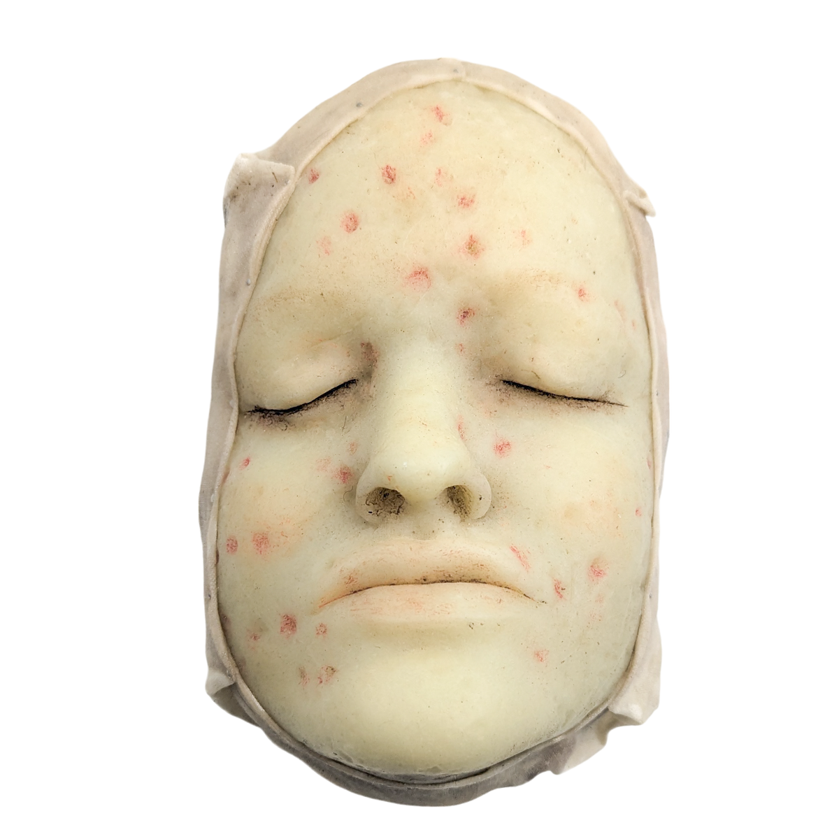 Antique Moulage Wax Pathology Model Face – Ballyhoo Curiosity Shop